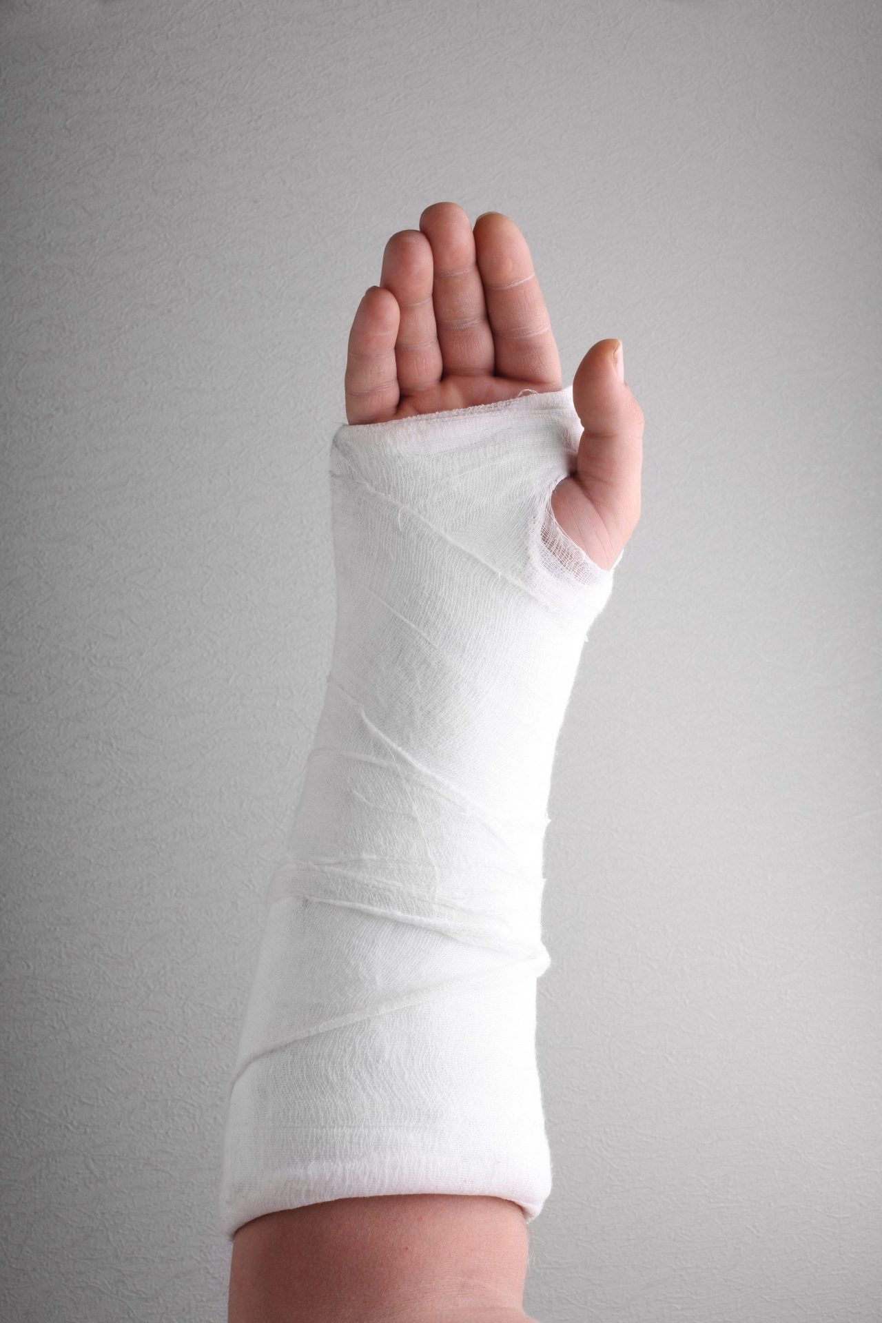 cast for hand | The Urgent Care
